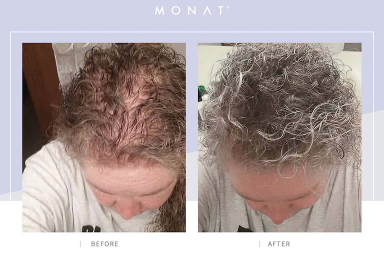 monat before and after - Mom Resource