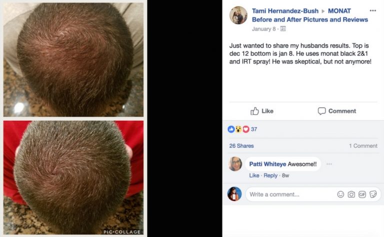 Regrow Hair Products - 7 Real Men Tell All With Before & After Pictures