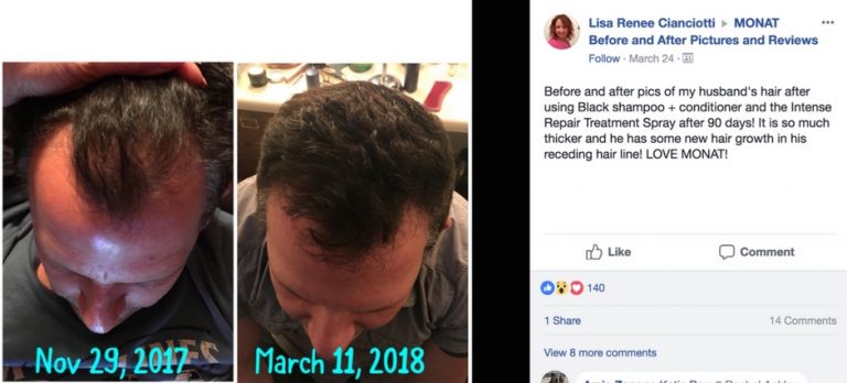 Regrow Hair Products - 7 Real Men Tell All With Before & After Pictures